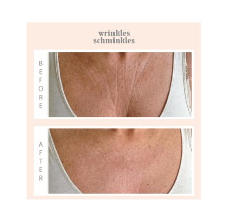 Chest & Decolletage Smoothing Kit | Skincare & Beauty Products Online ...